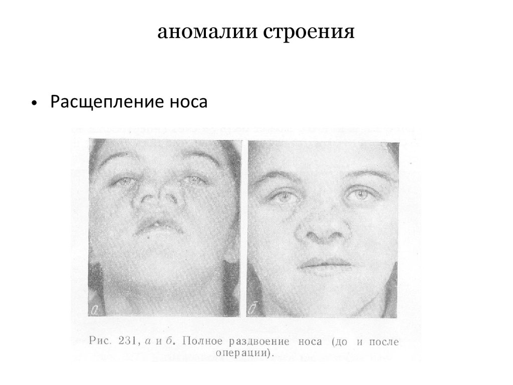 Варианты и аномалии развития органов дыхательной системы человека ...