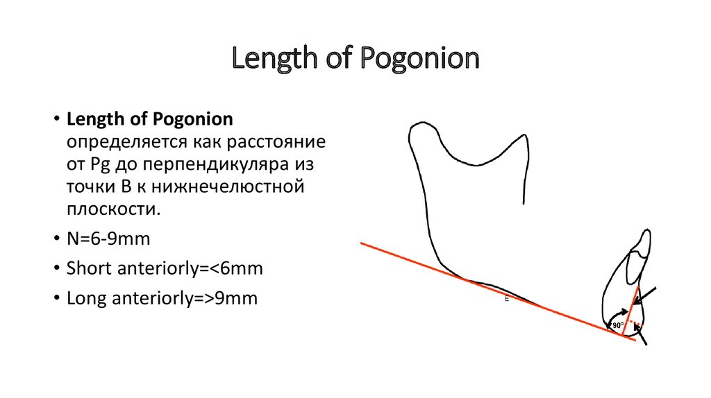 Черепные ориентиры - презентация онлайн