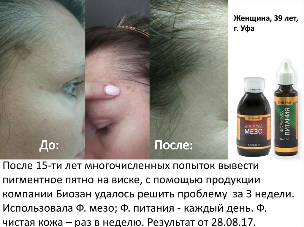 Результаты применения продукции Биозан - презентация онлайн