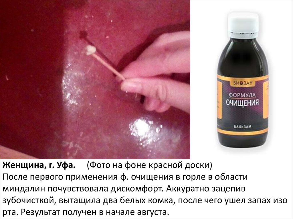 Результаты применения продукции Биозан - презентация онлайн