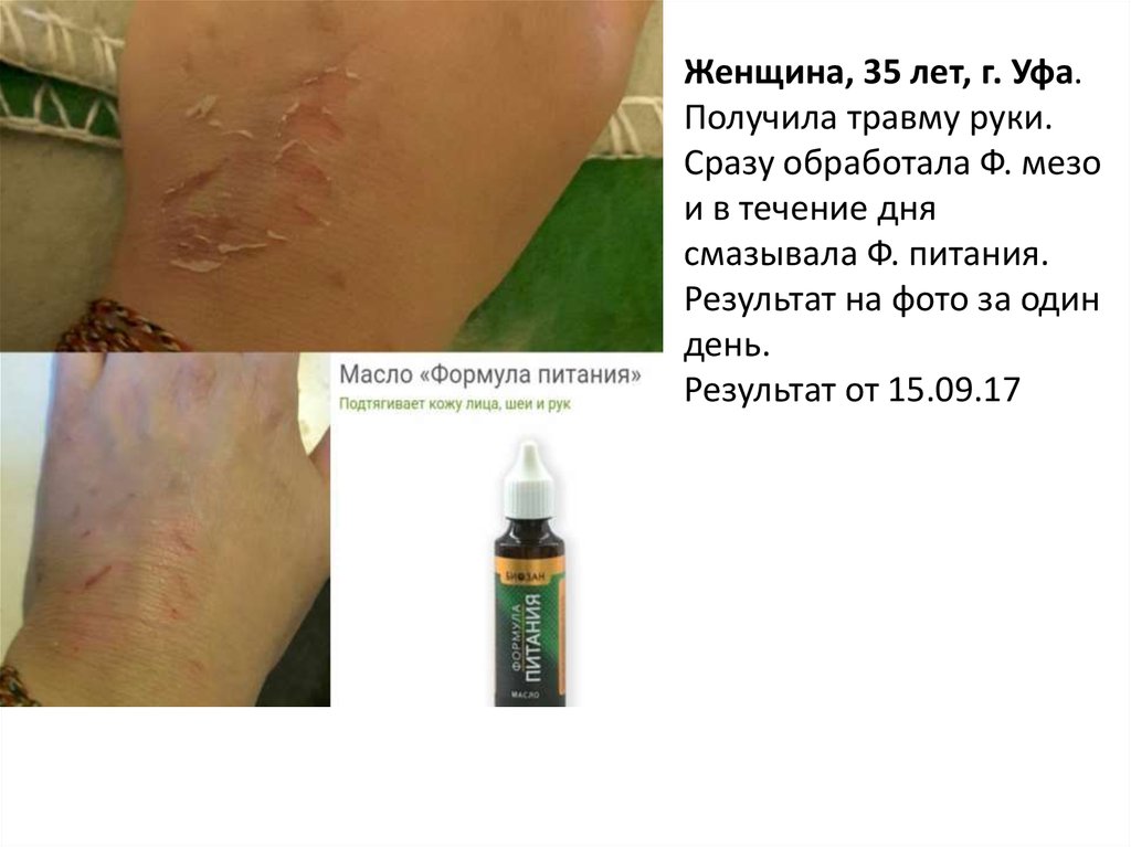 Результаты применения продукции Биозан - презентация онлайн