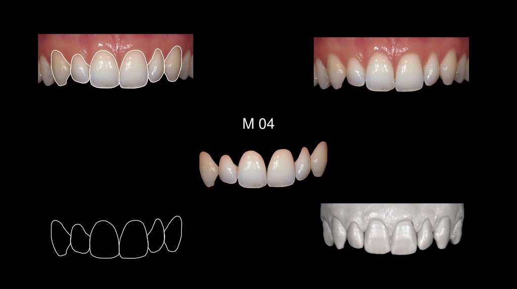DSD - Database Éléments - online presentation