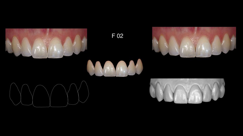 DSD - Database Éléments - online presentation