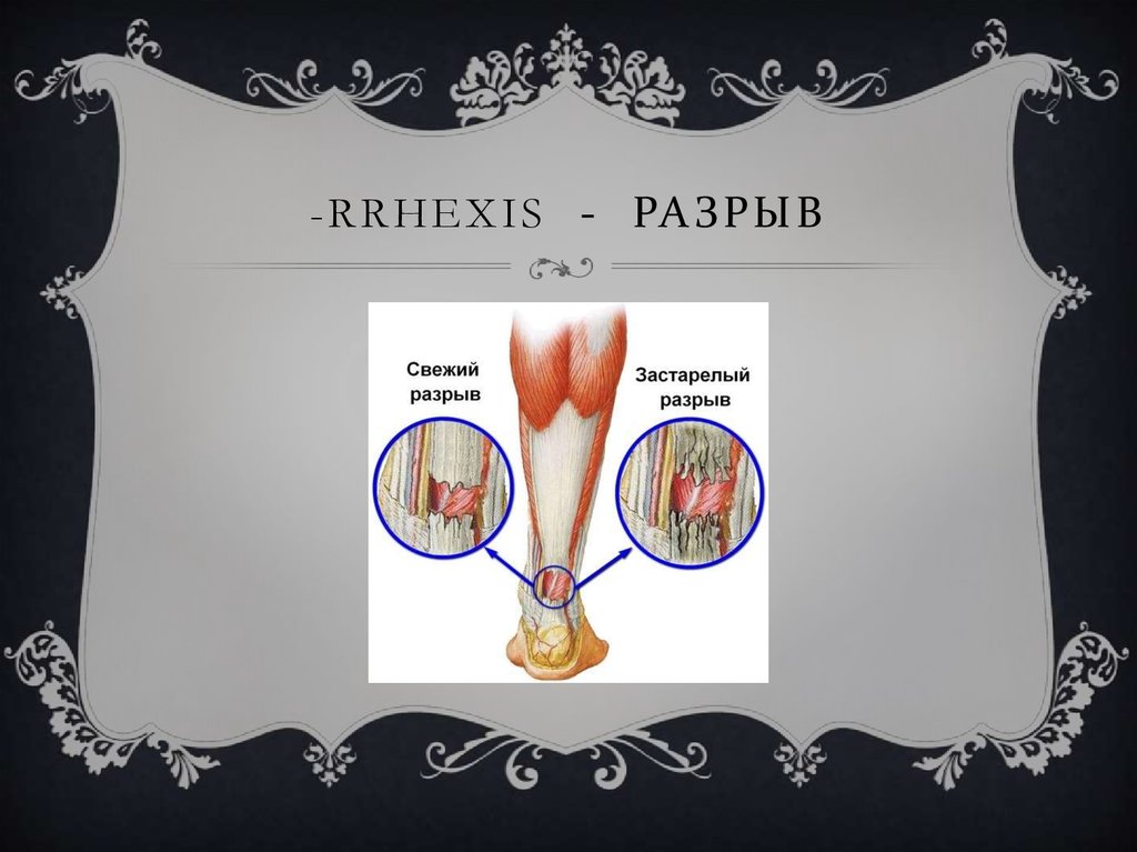 Терминоэлементы - презентация онлайн