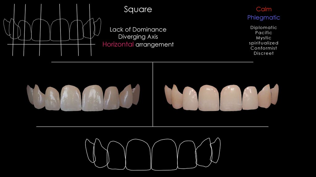 DSD template Online Presentation