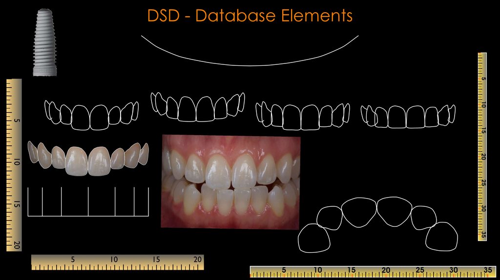 DSD template Online Presentation